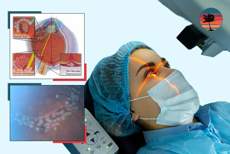 Retinal Laser Treatment for Safer, Healthier Vision
